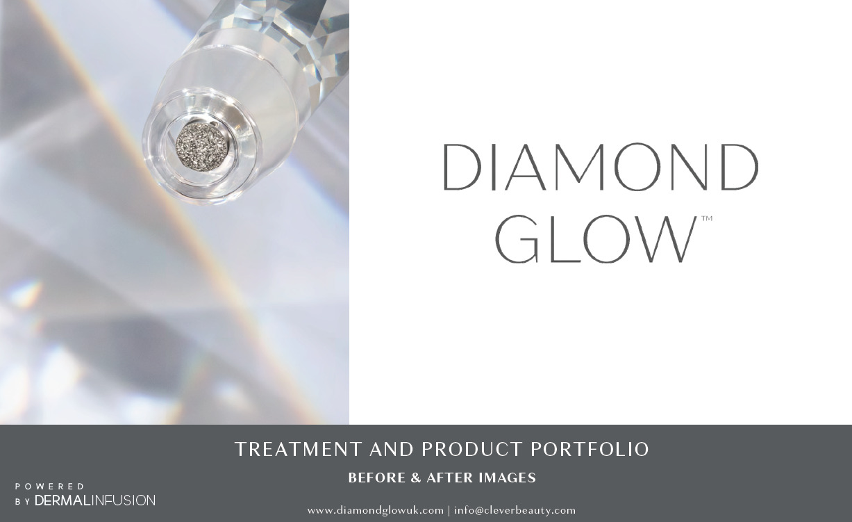 DiamondGlow® Before & Afters - Clever Beauty